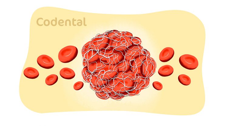 Fibrina: saiba tudo sobre seu uso na odontologia
