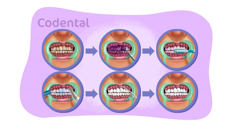 Esterilização Odontológica: passo a passo completo de como fazer!